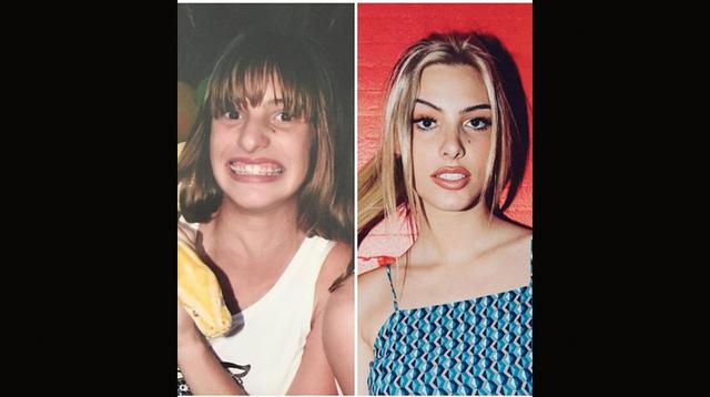 YouTube: Lele Pons confesó que solo se ha hecho una cirugía en toda su ...
